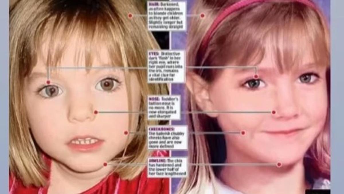 Coloboma Así Es El Defecto Ocular Que Tienen En Común Madeleine Mccann